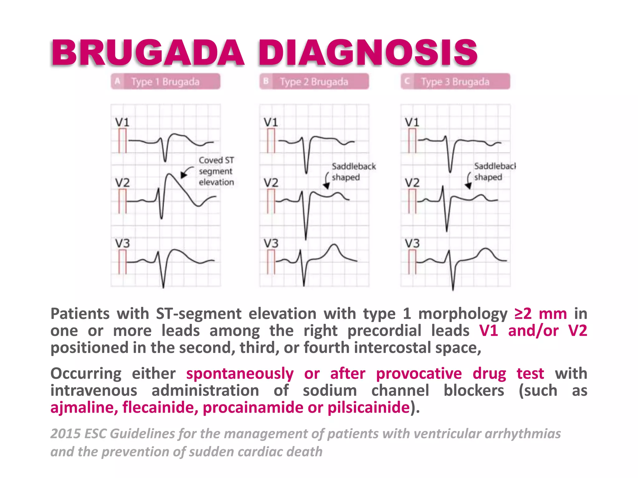 Cardiac action potential | PPTX