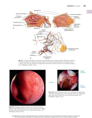 CAP 47. Epistaxis.pdf