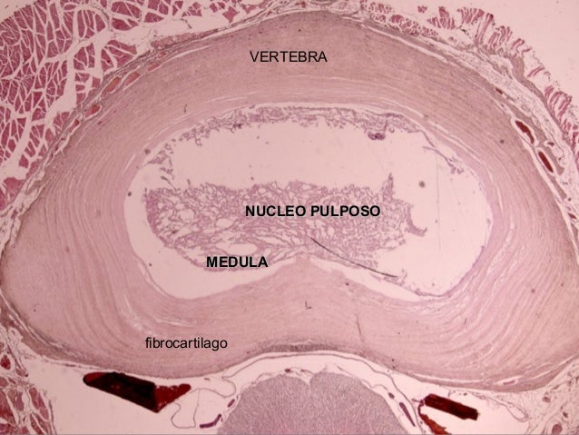 Cap6 cartilagoyhueso