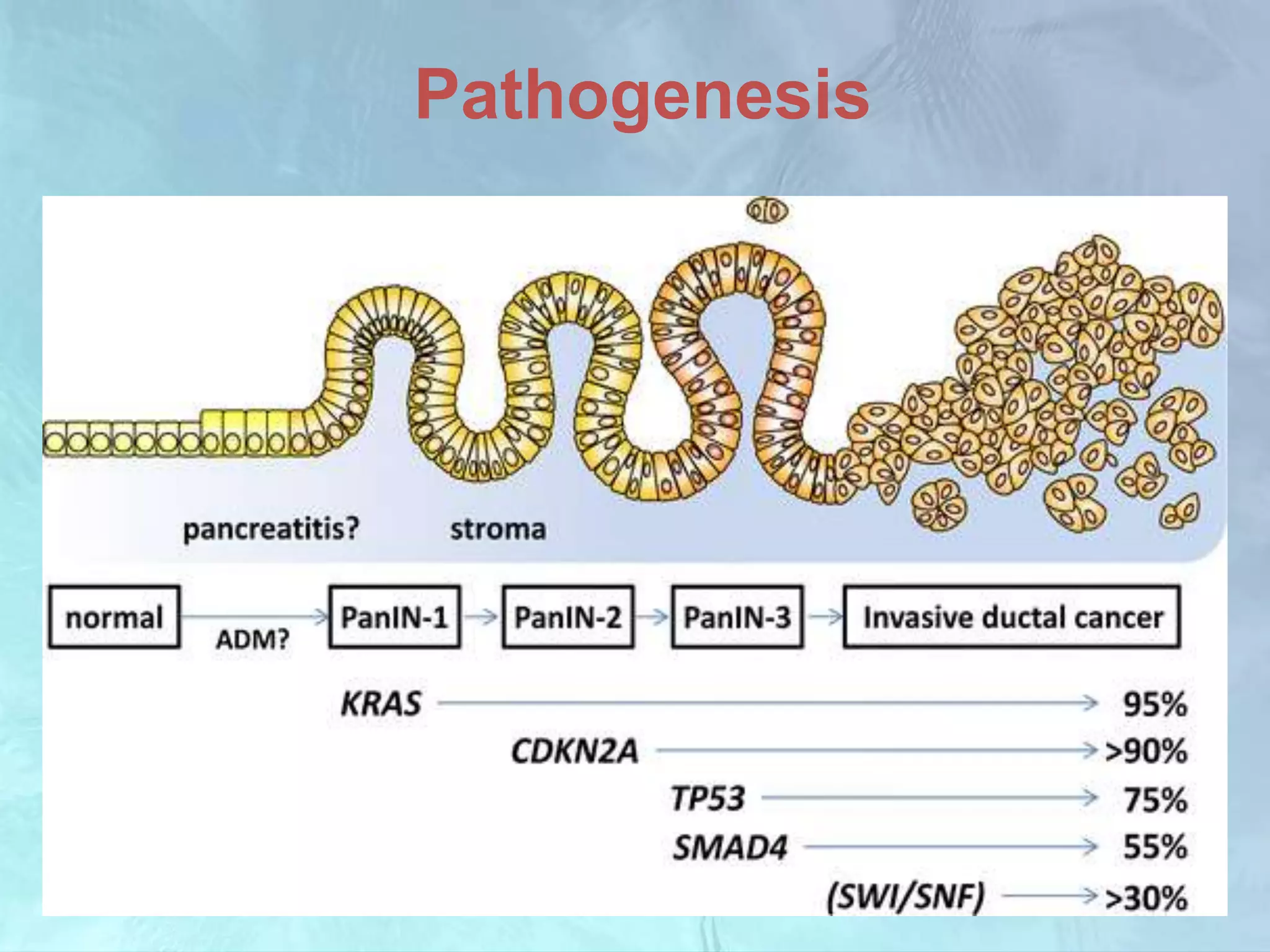 Ca pancreas [autosaved] | PPTX