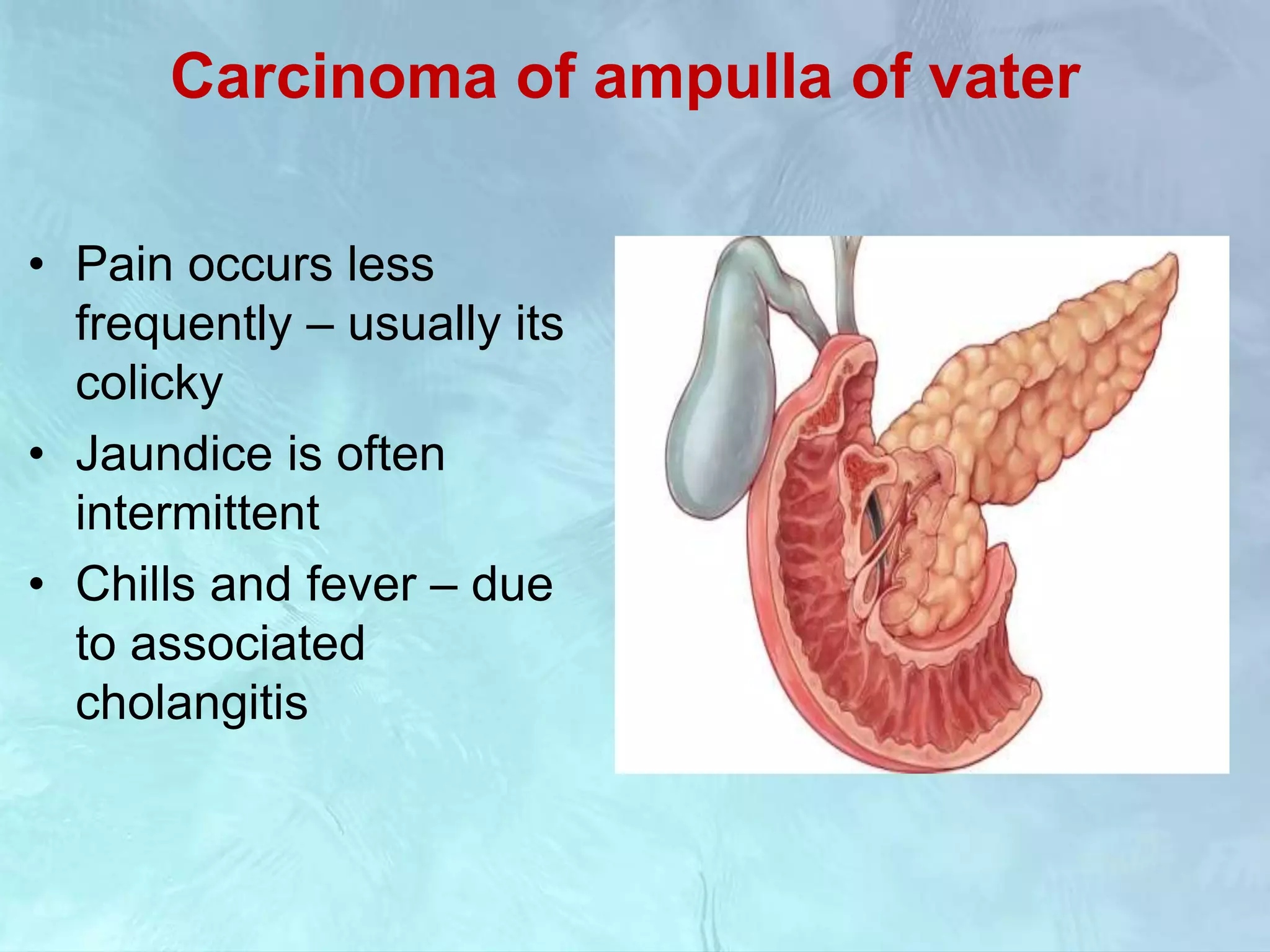 Ca pancreas [autosaved] | PPTX