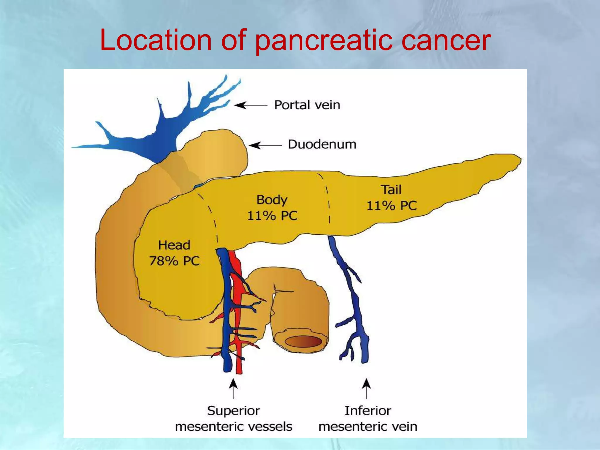 Ca pancreas [autosaved] | PPTX