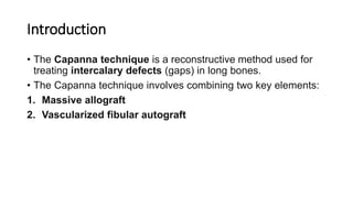 Capanna technique for chronic osteomyelitis | PPT