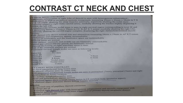 Ca Papillary Thyroid Gland Ppt