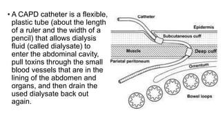 CAPD Catheters.pptx