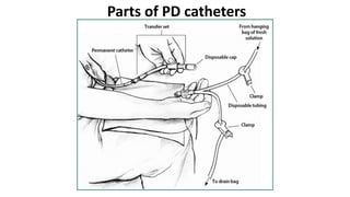 CAPD Catheters.pptx