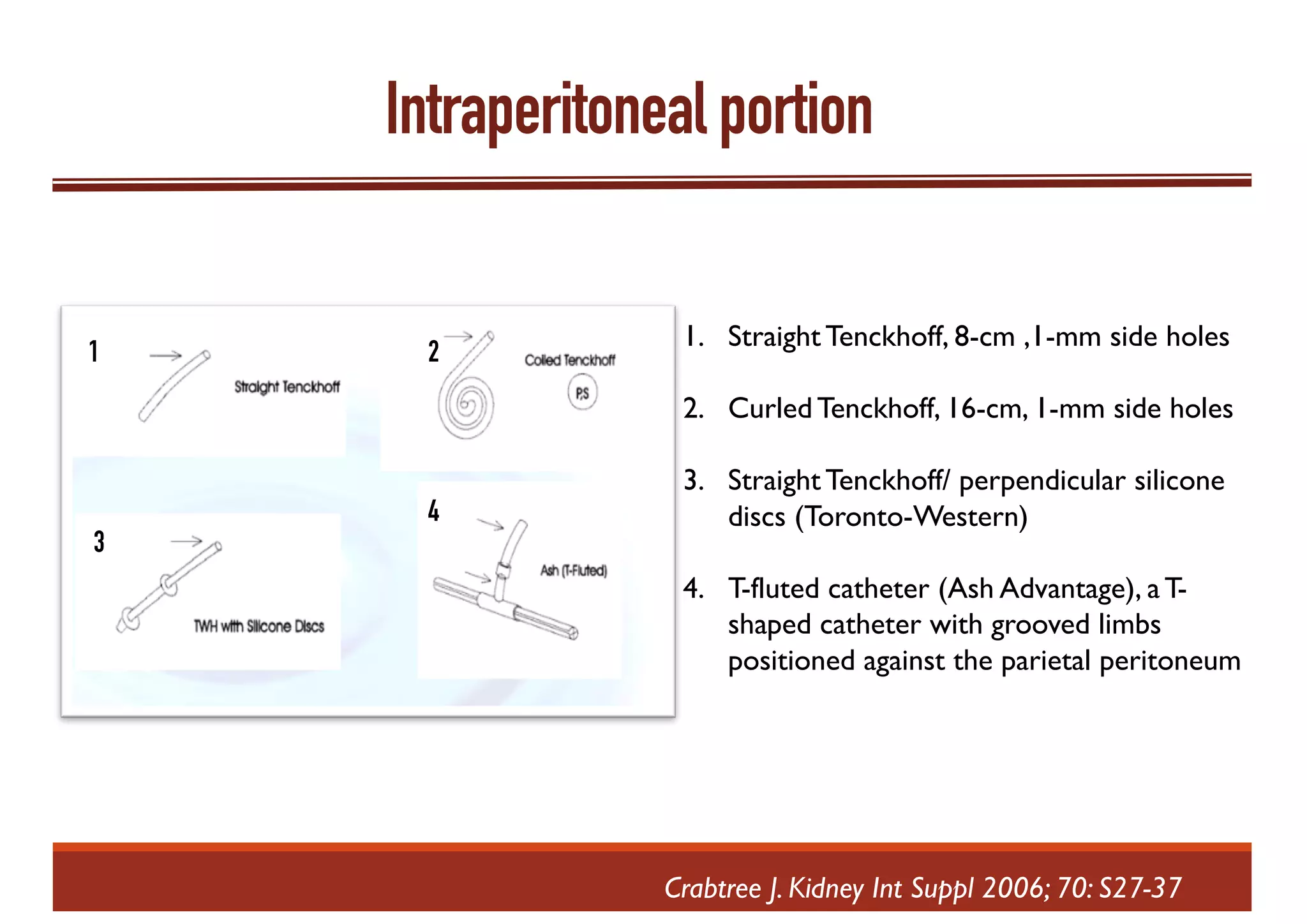 Peritoneal Dialysis catheter complication CAPD Chaken 2017 | PPT