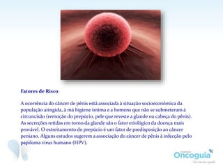 Câncer de Pênis | PPTX
