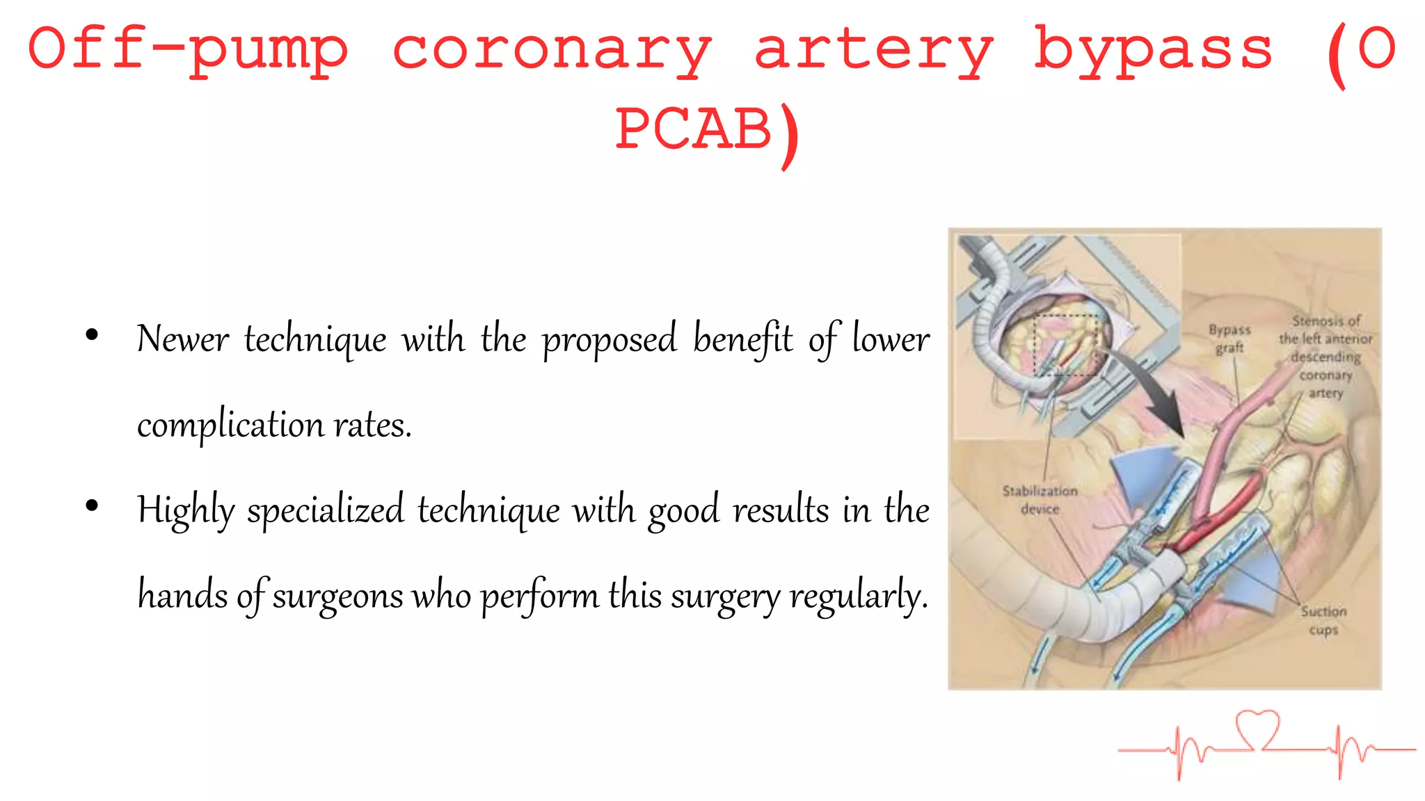 CABG | PPTX