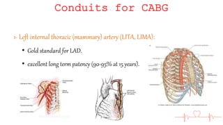 CABG | PPTX