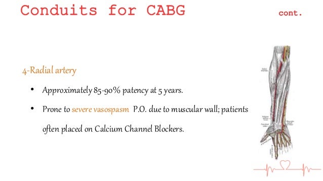 CABG