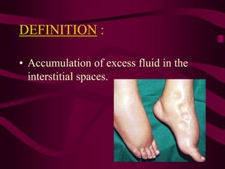 Capillary circulation & fluid exchange.pdf