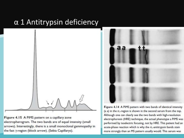 Capillary electrophoresis principles and applications | PPTX