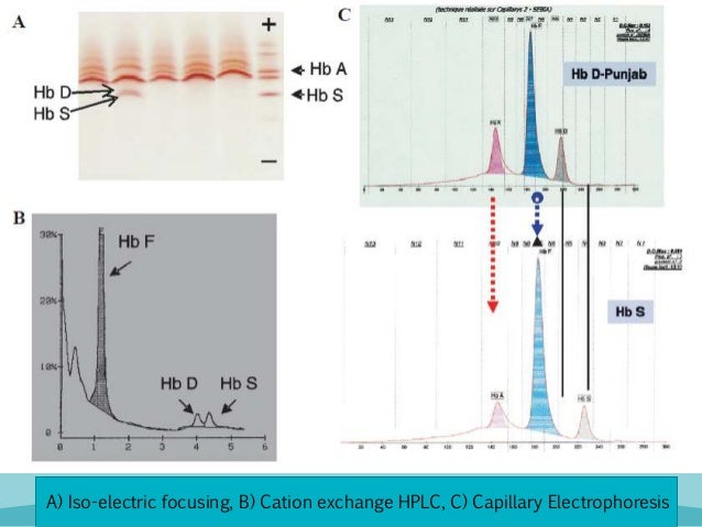 Capillary electrophoresis principles and applications