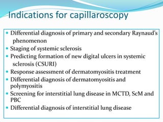 capillaroscopy | PPTX