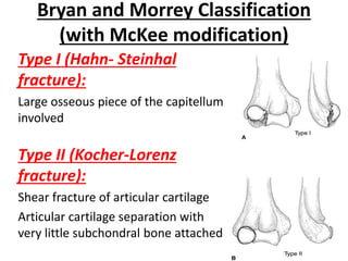 Capitellum fractures | PPT