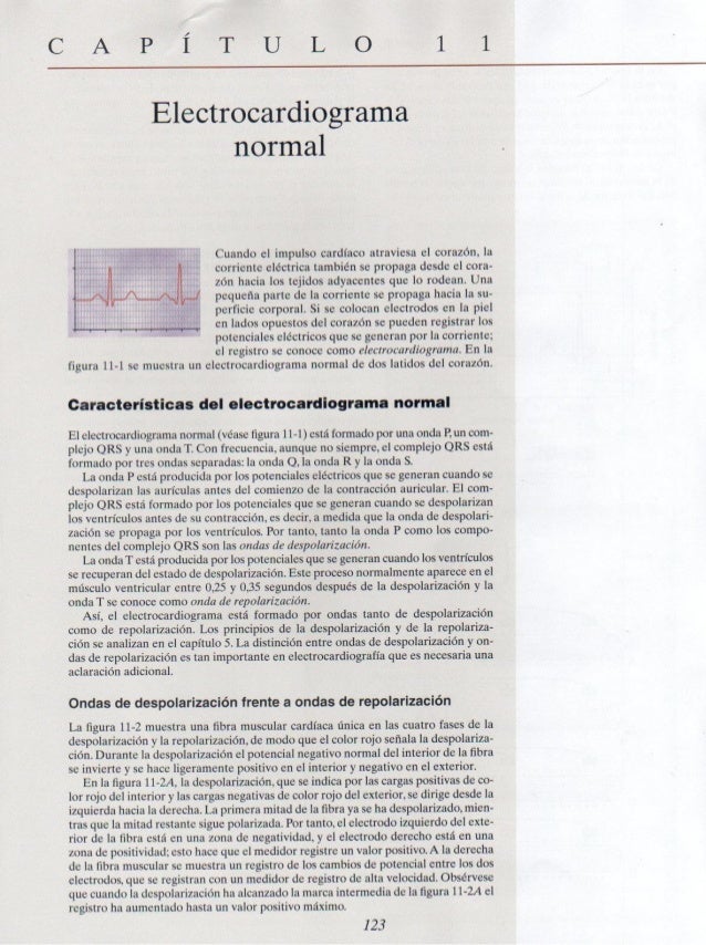 Electrocardiograma Normal