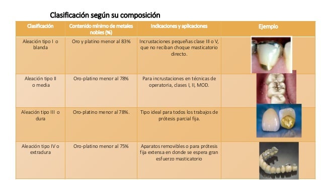 Aleaciones Dentales para colado