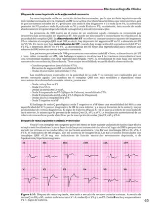Curso ECG Intramed Capitulo 6 | PDF