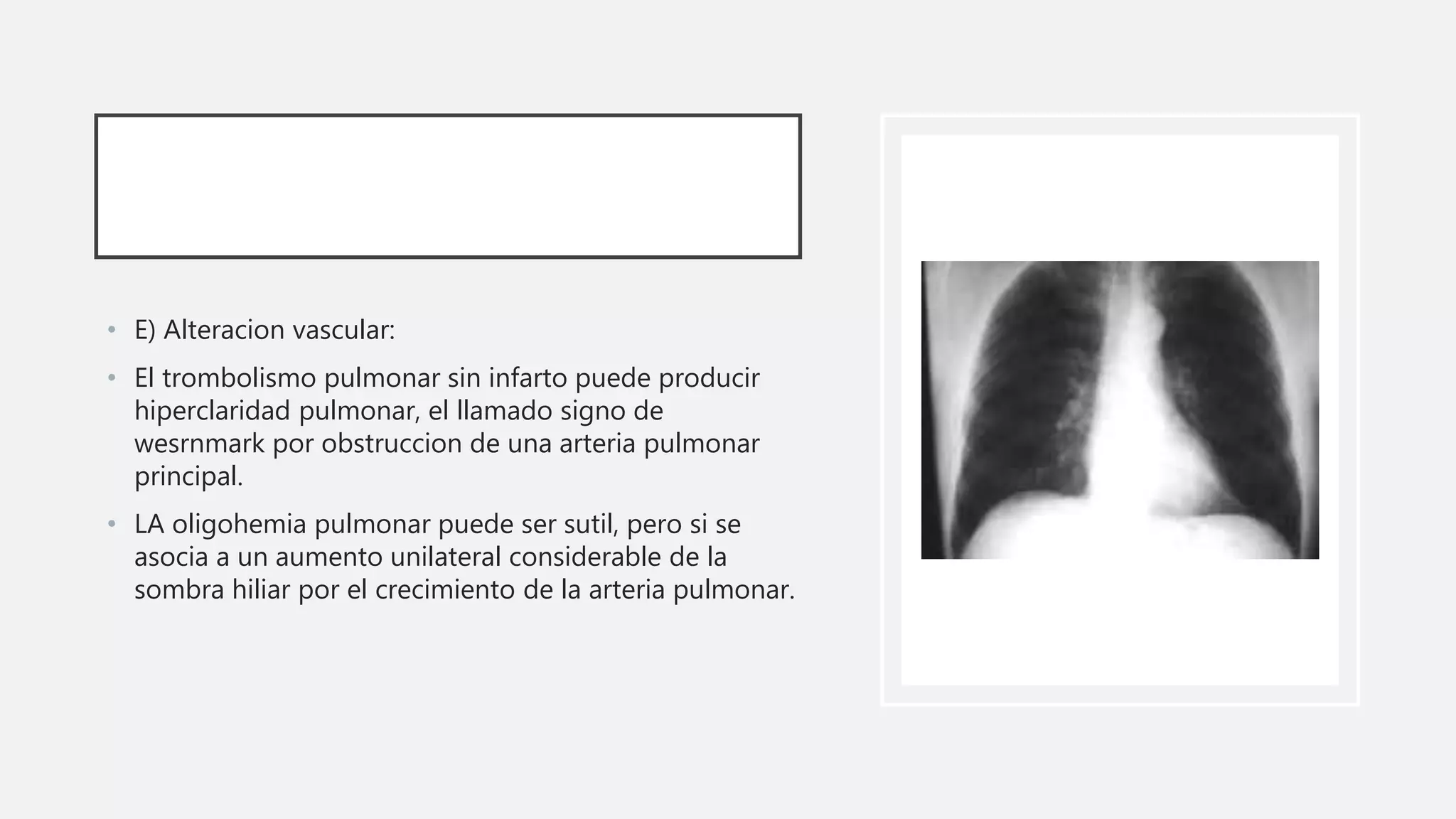 Pedrosa Radiologia e imagenologia El torax; hiperclaridad pulmonar ...