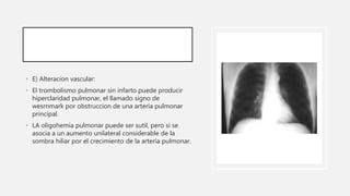 Pedrosa Radiologia e imagenologia El torax; hiperclaridad pulmonar ...