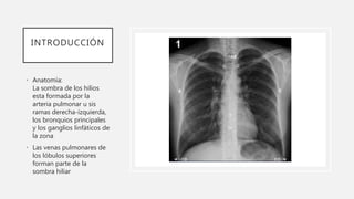 Pedrosa Radiologia e imagenologia El torax; hiperclaridad pulmonar ...