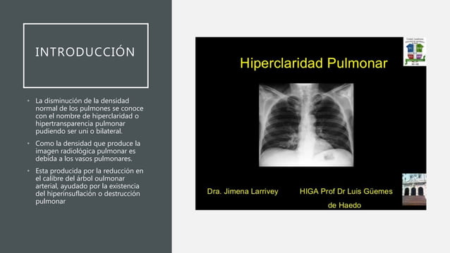 Pedrosa Radiologia e imagenologia El torax; hiperclaridad pulmonar ...