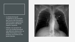 Pedrosa Radiologia e imagenologia El torax; hiperclaridad pulmonar ...