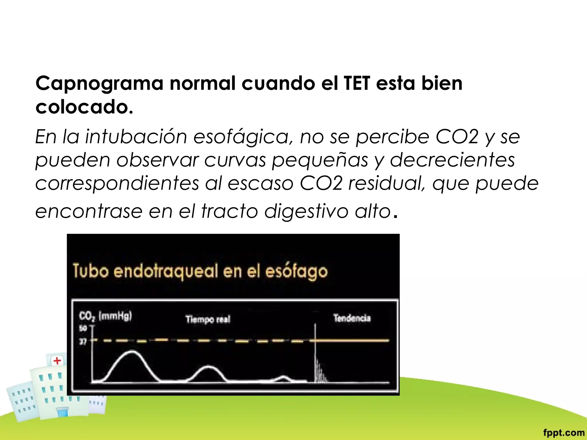 Capnografia | PPT