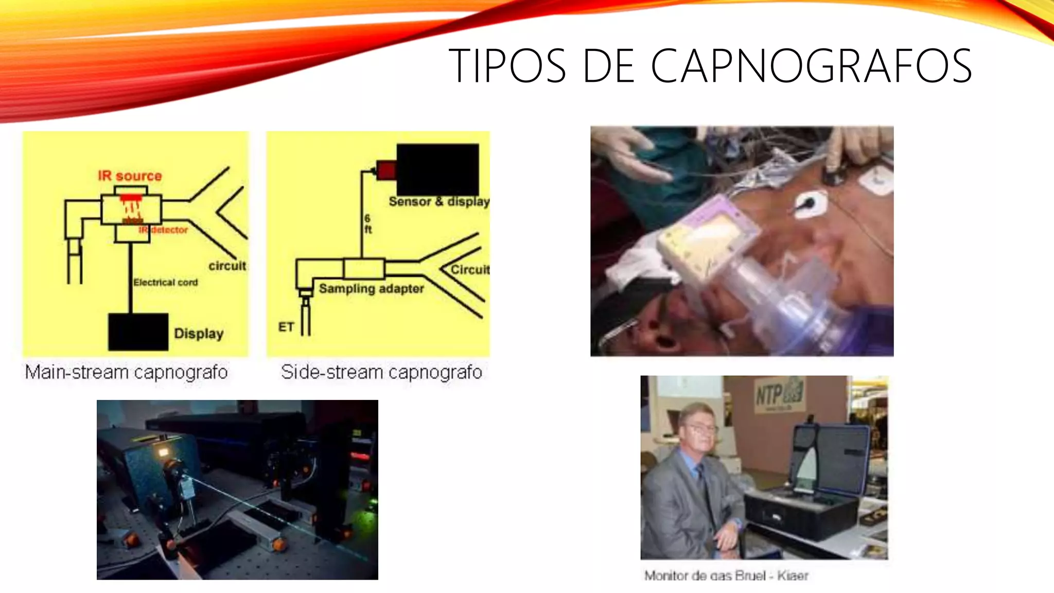 Capnografia | PPTX