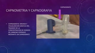 CAPNOGRAFIA.pptx