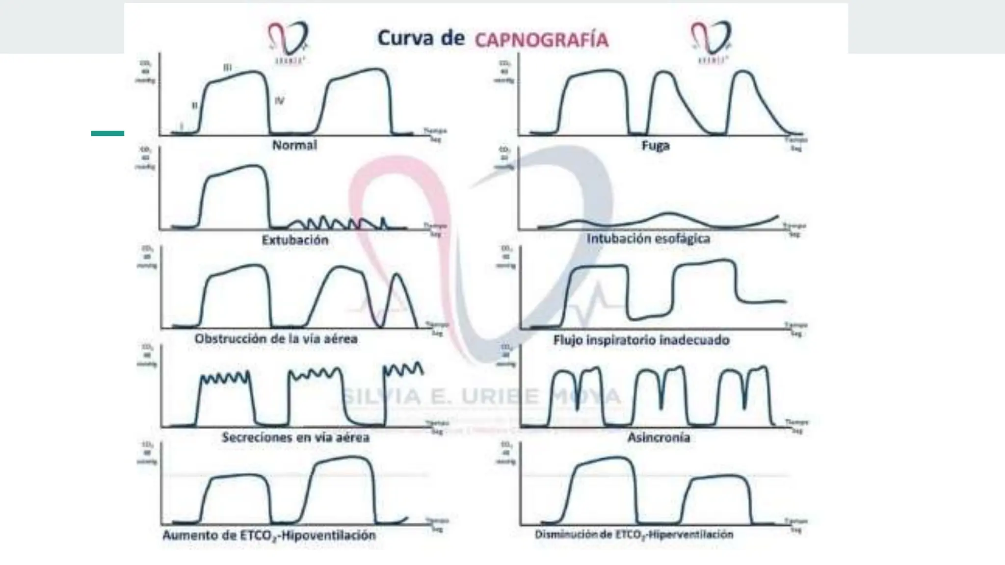curva de capnografia .......... | PPTX | Lung and Respiratory Health ...