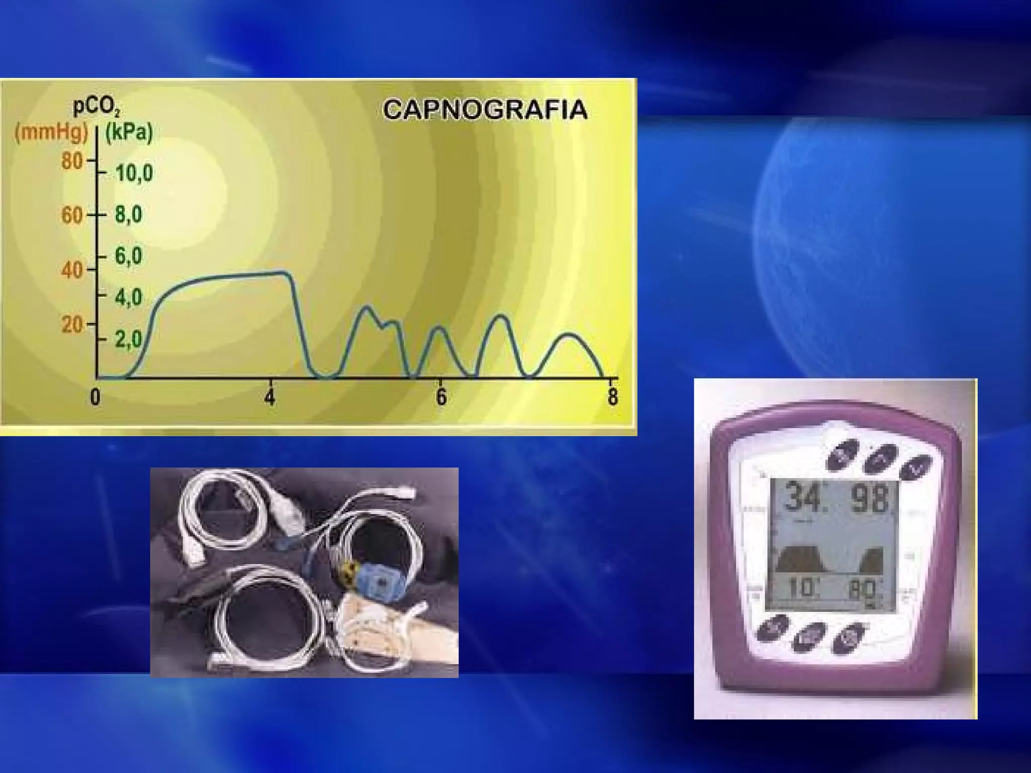 Capnografia y pulsioximetria | PPT