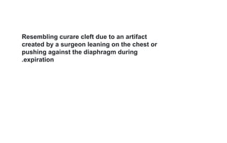 Capnogram and Spirometry principles and its uses in Operation theatres ...
