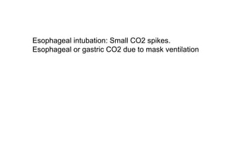 Capnogram and Spirometry principles and its uses in Operation theatres ...