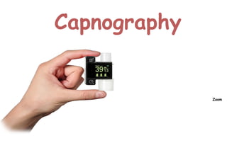 Capnogram and Spirometry principles and its uses in Operation theatres ...