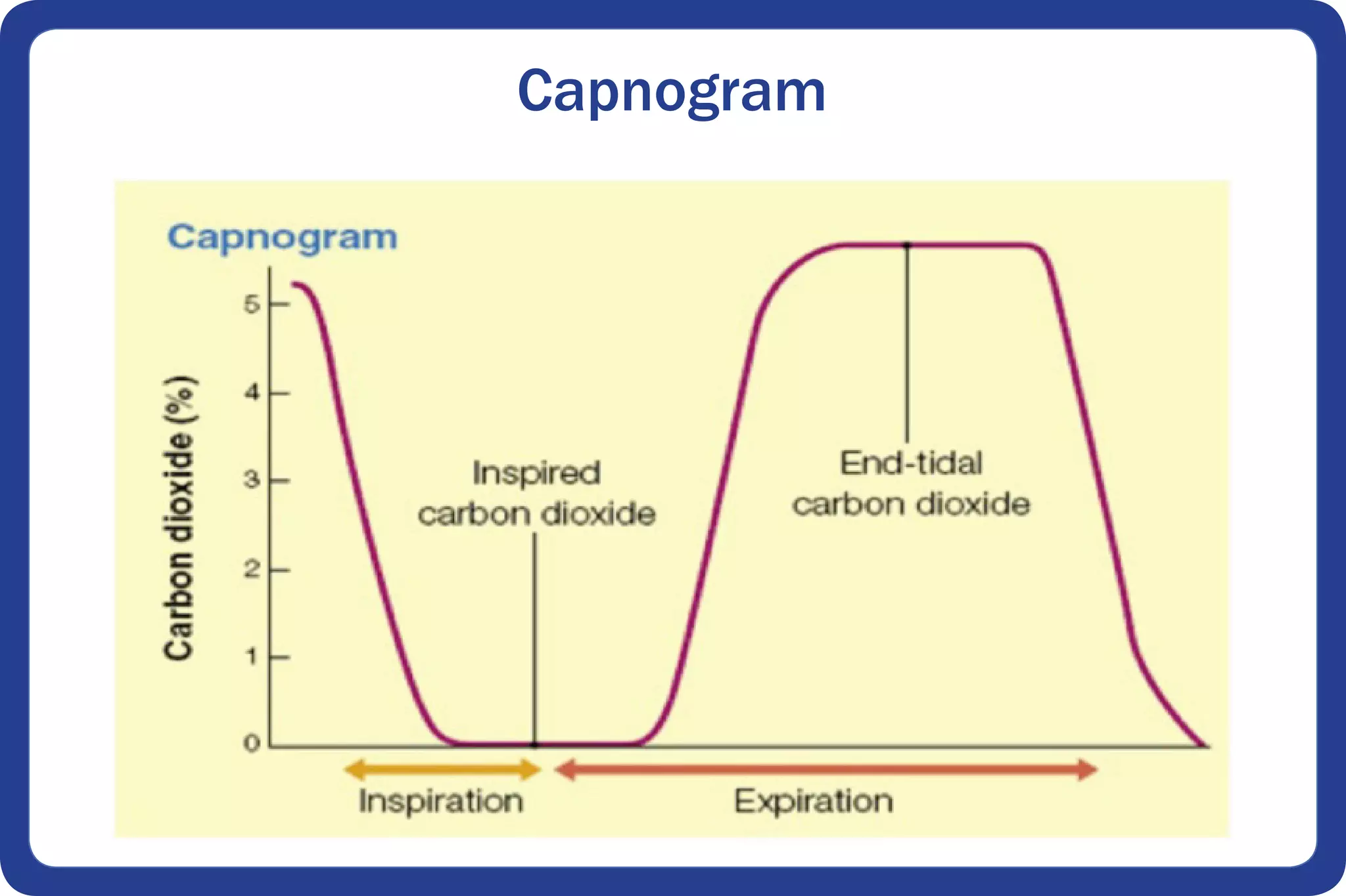 Capnograph Training Cards 5-2019.pdf