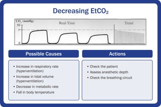 Capnograph Training Cards 5-2019.pdf