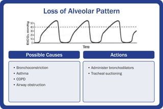 Capnograph Training Cards 5-2019.pdf