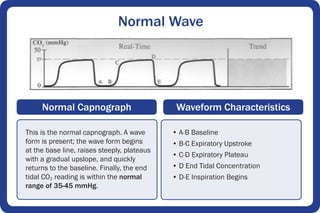 Capnograph Training Cards 5-2019.pdf