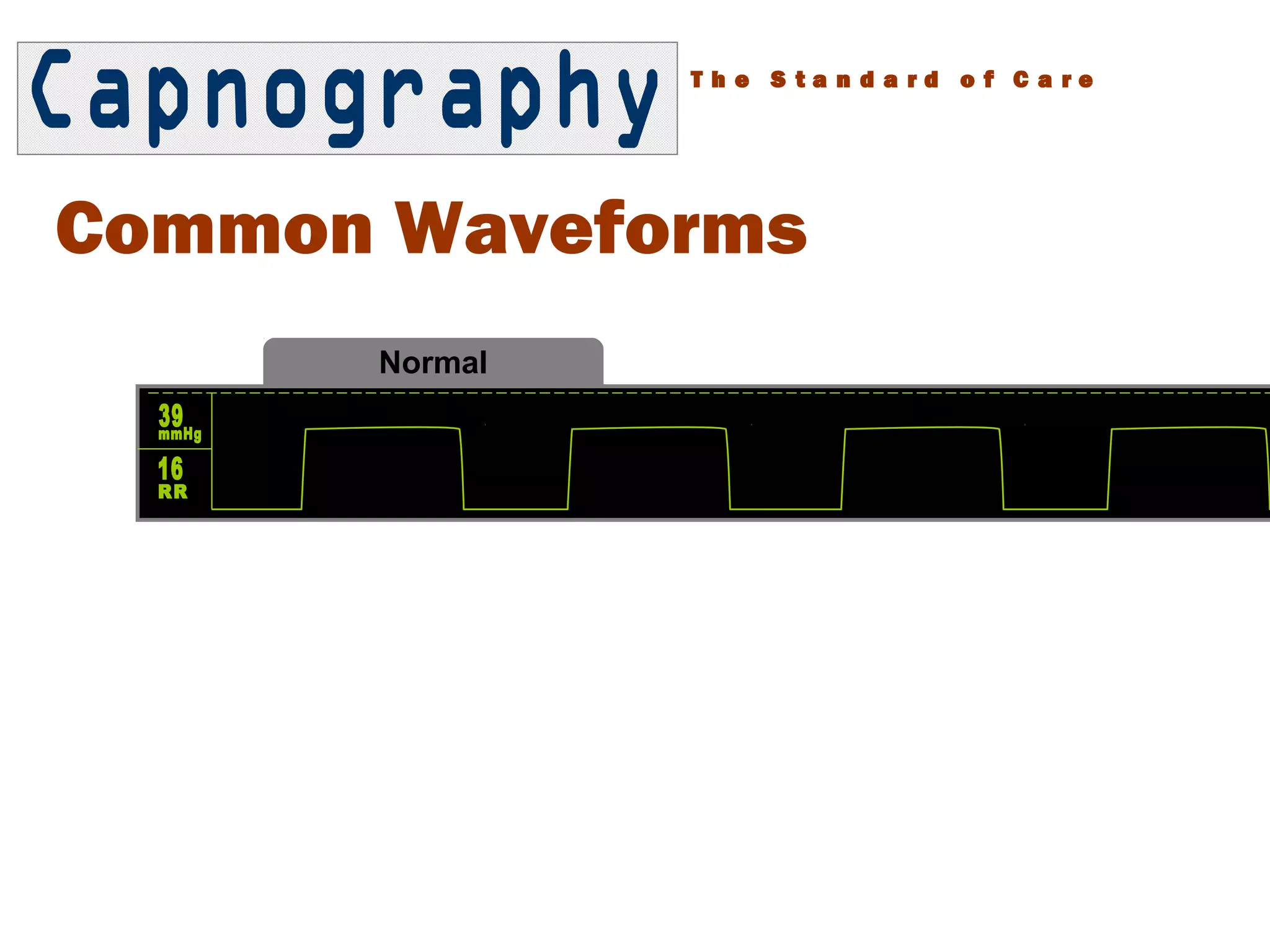 Capnography | PPT