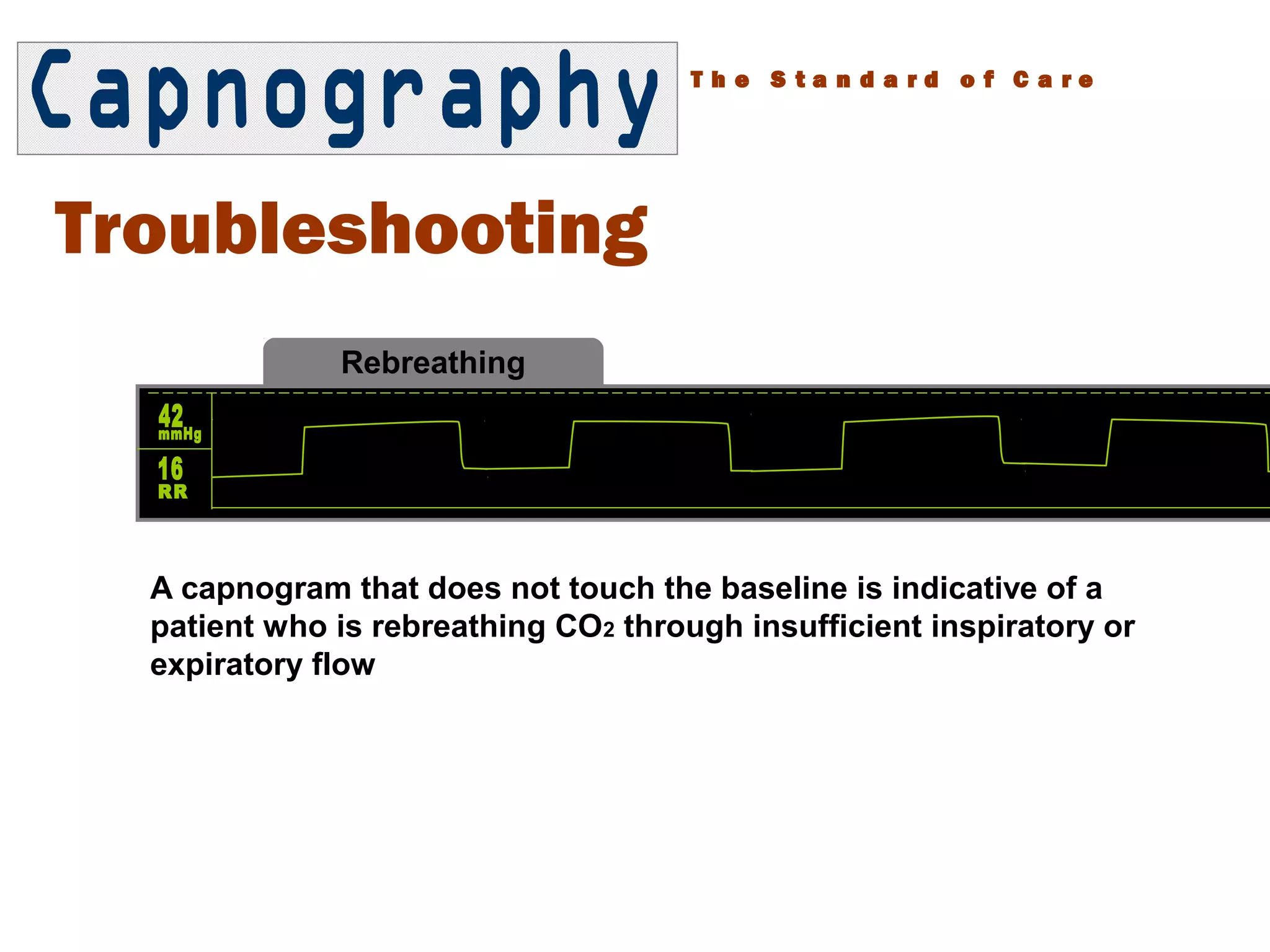 Capnography | PPT