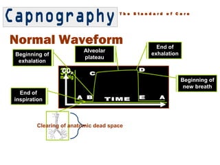 Capnography | PPT