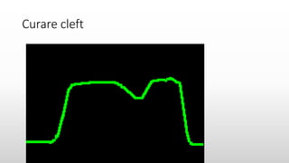 Capnography | PPTX
