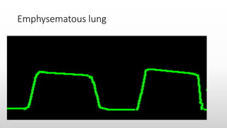 Capnography | PPTX