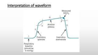 Capnography | PPTX