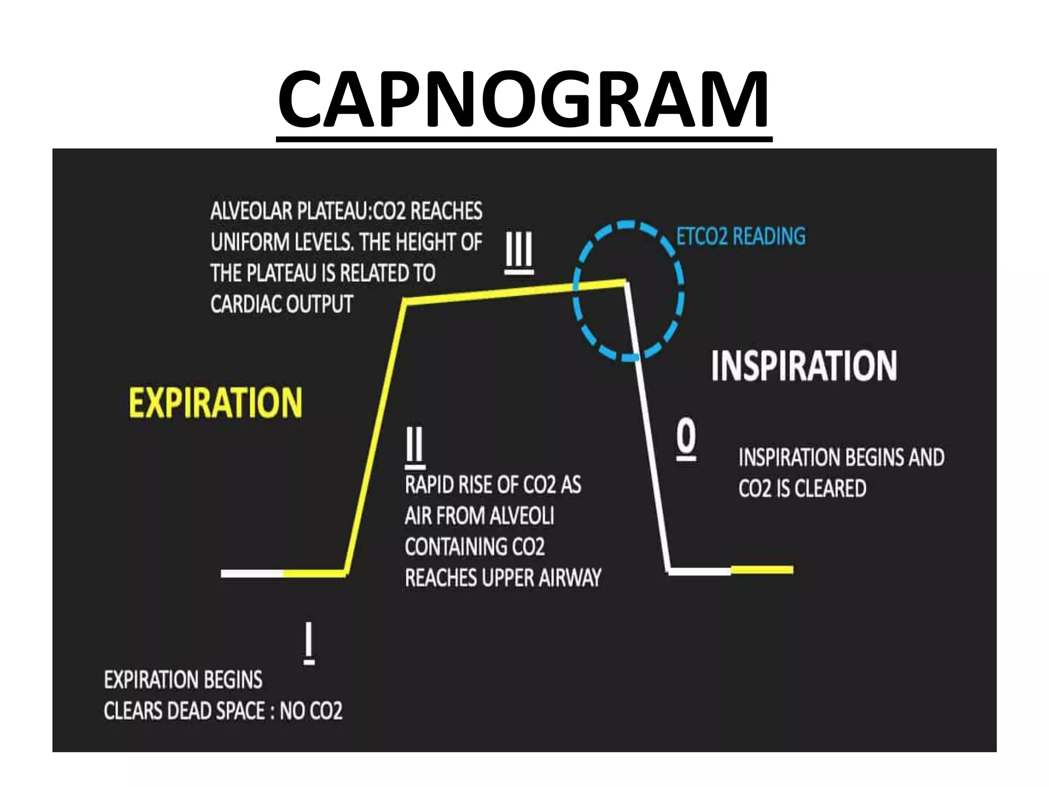 CAPNOGRAPHY | PPTX