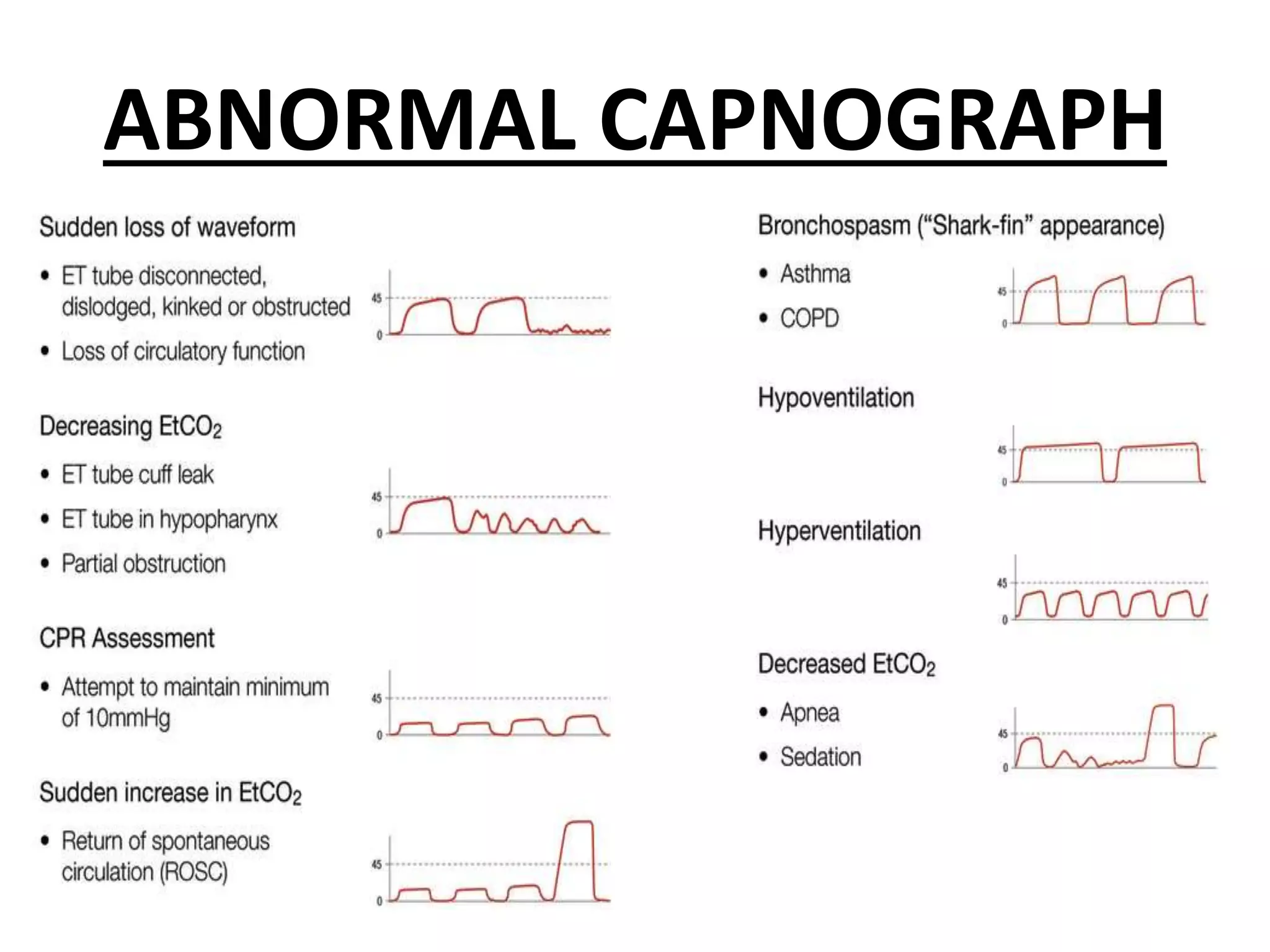 CAPNOGRAPHY | PPTX