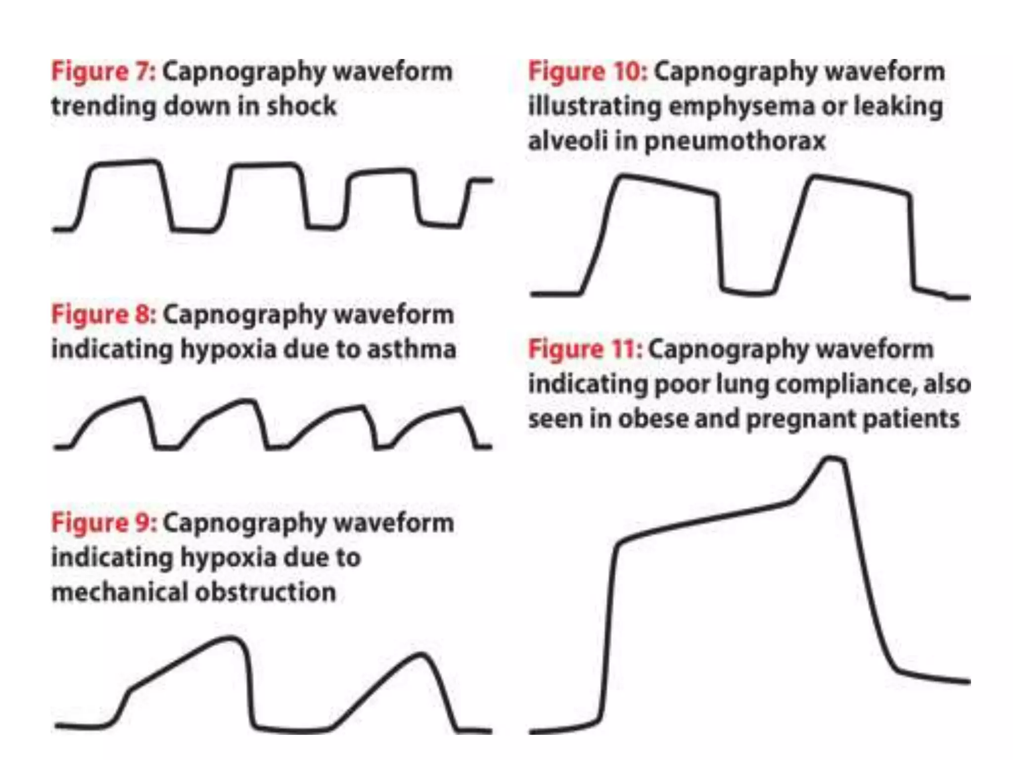 CAPNOGRAPHY | PPTX