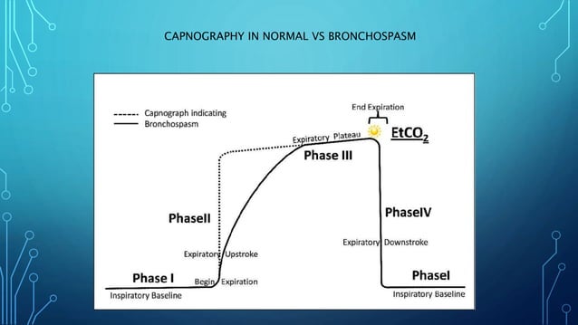 Basics Of Capnography Pptx